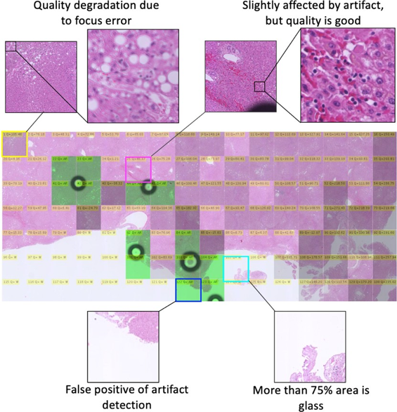 Image quality evaluation of whole slide image (WSI) – Yamaguchi Lab