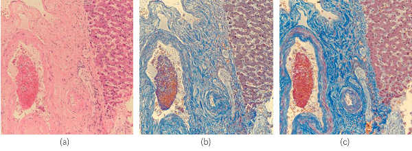 デジタル染色 – Yamaguchi Lab